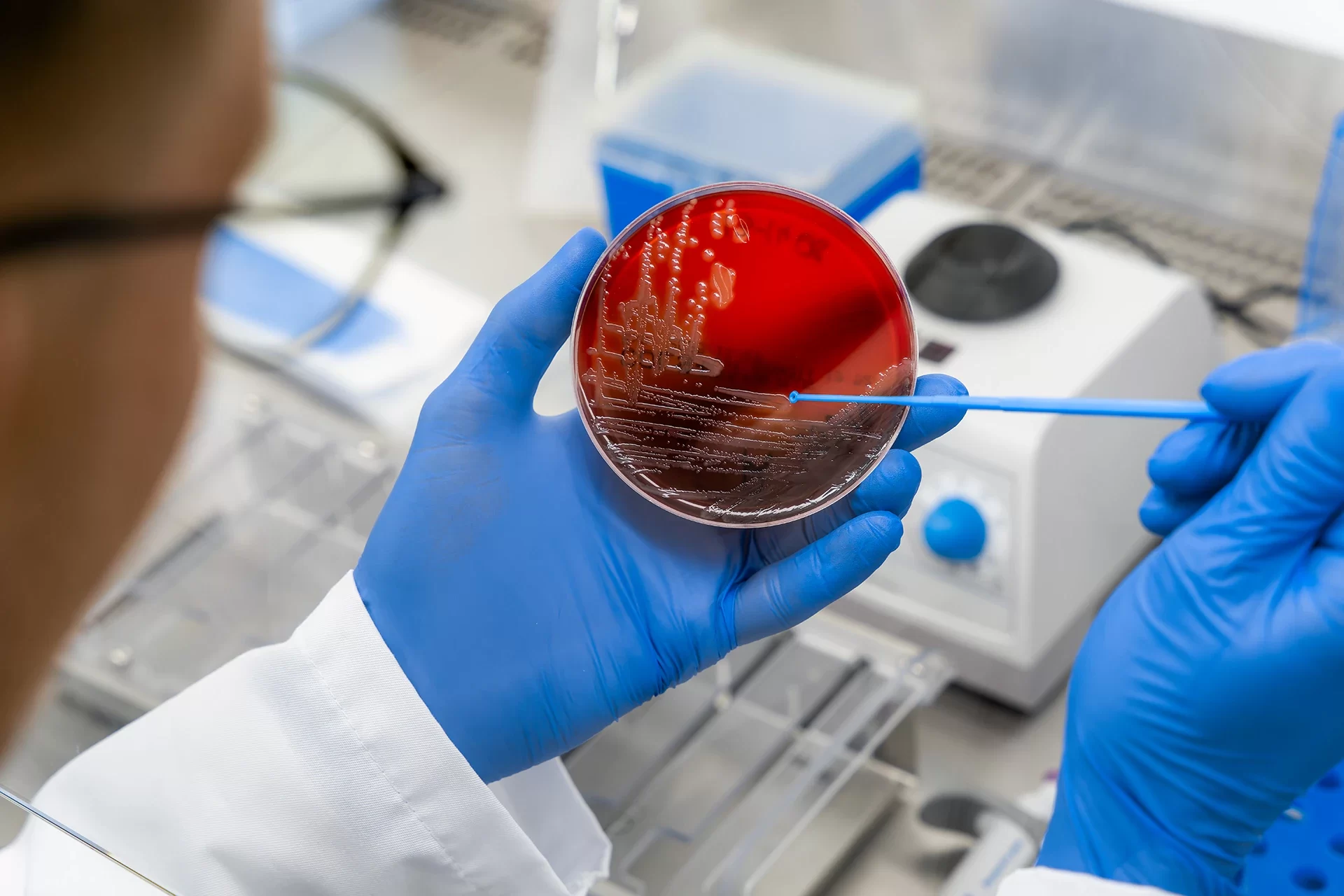 Why Do Children Get Sick More Often? - BACTEROMIC